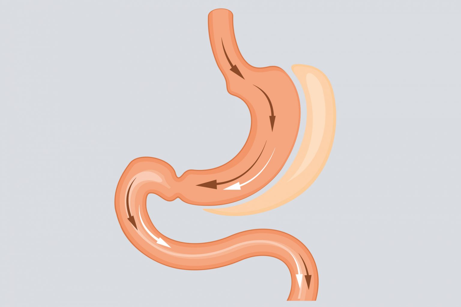 Bariatric Surgery | international-patients.com